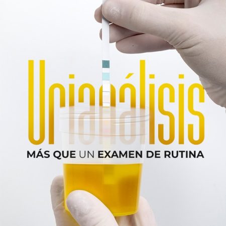 Urianálisis: Clave para revelar secretos sobre la salud renal y urinaria - Grupo Corporinter